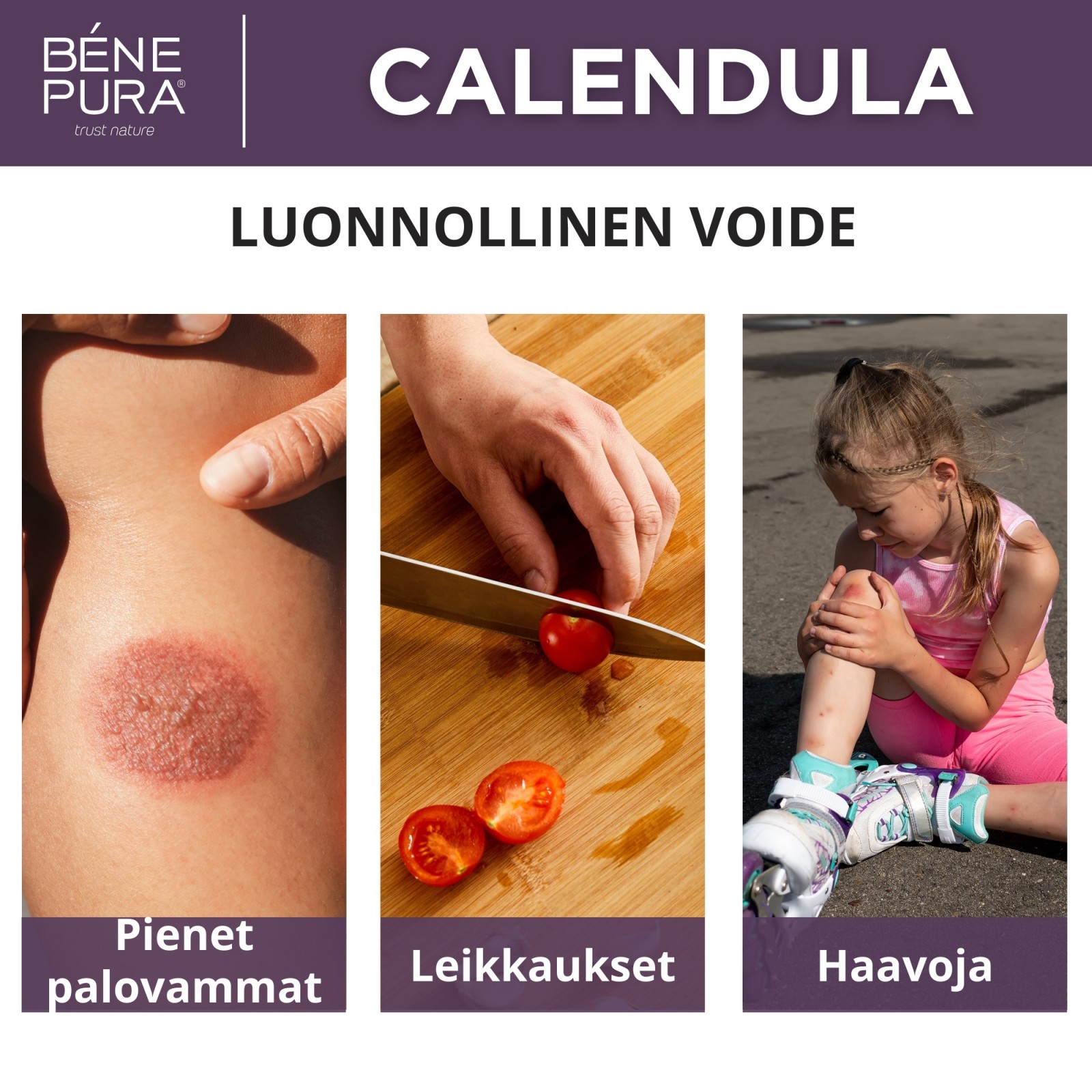 ᐉ 3x Voide Palovamma ja Haava kanssa Kehäkukka, Aloe Vera ja Mäkikuisma ...